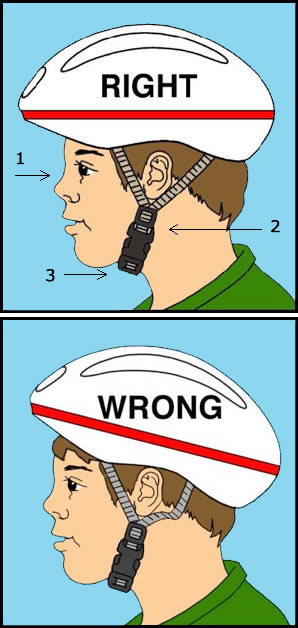 Brain Injury Prevention In Sports | For Athletes Trainers And Coaches