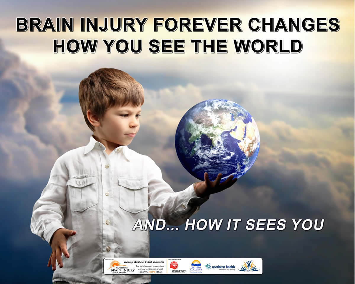 NBIA Brain Injury Prevention Posters – Landscape