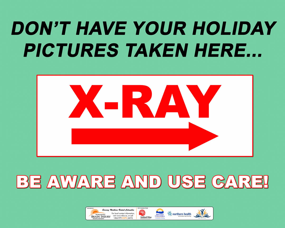 Symptoms Of Brain Injury | Northern Brain Injury Association | BC